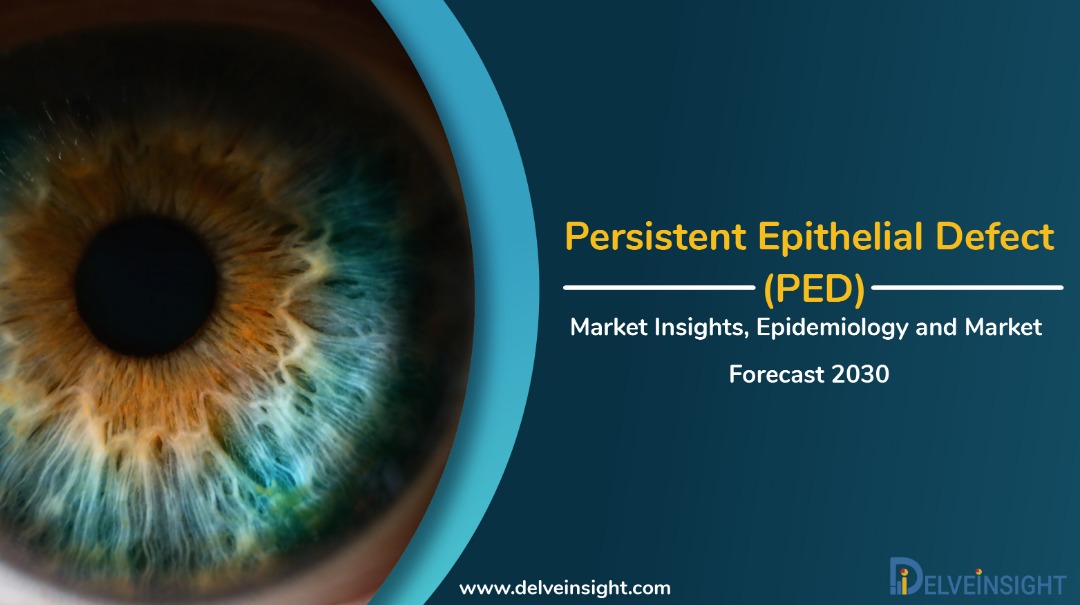 Persistent Epithelial Defect (PED) Market Trends, Market Size & Share ...
